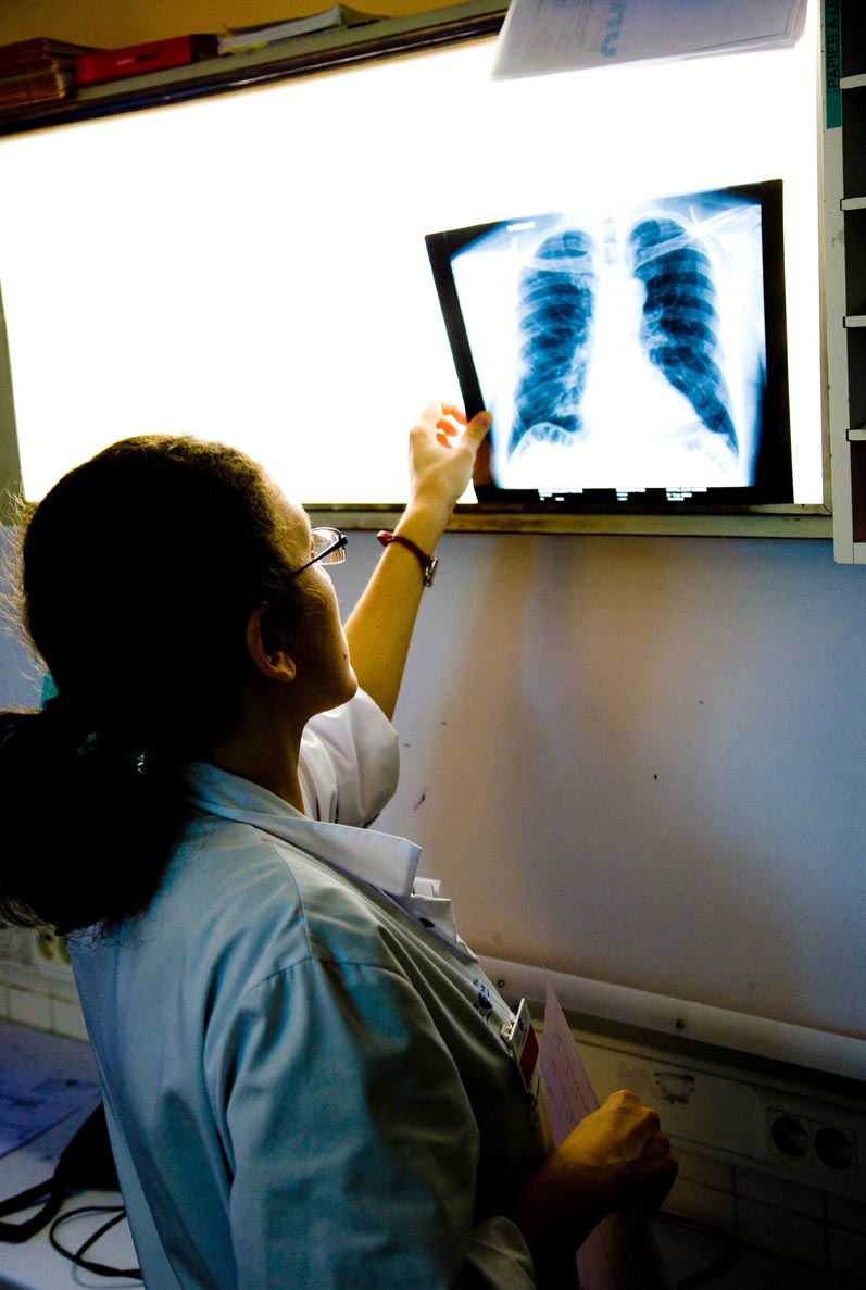 LDCT screening and lung cancer