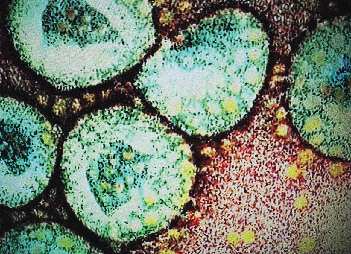 Study of novel coronavirus suggests longer incubation