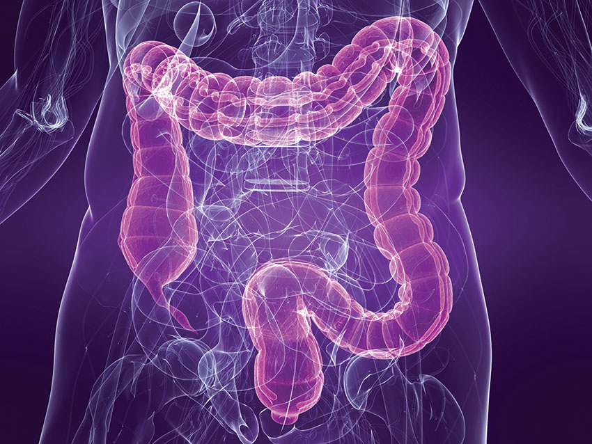 Customised management of IBD