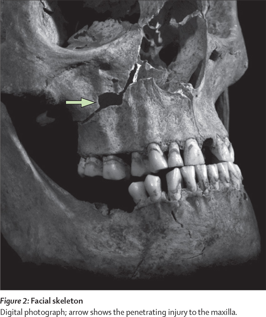 Richard III also gave battle in vain