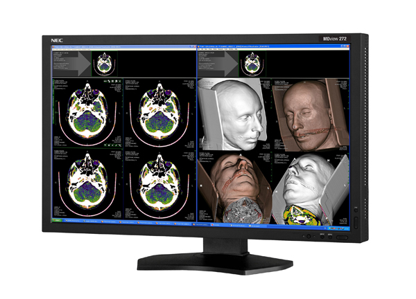 NEC Display Solutions unveils MDview272 reference and referral display ...